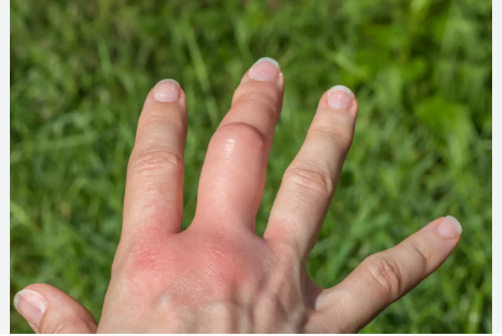 If these 5 parts of the body swell, they can be a sign